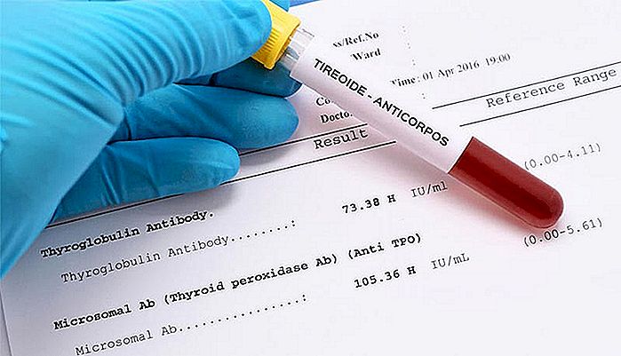 Anti-tiroglobulina mărită: Ce înseamnă și de ce ar trebui să te ...