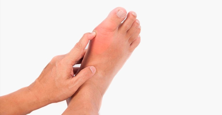 Mierea la gută: Cum să pregătești remediul naturist