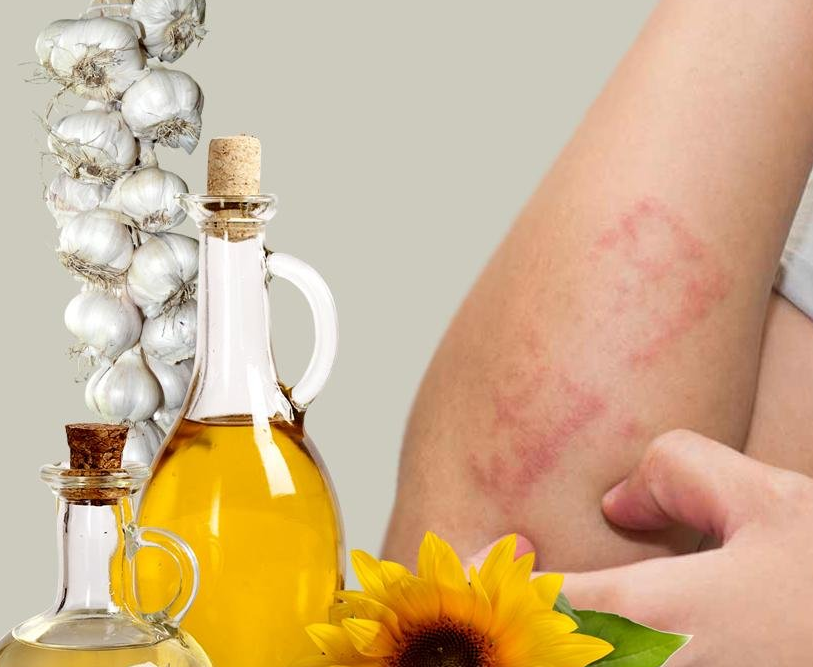 Usturoi pentru râie: Remediul care te va salva de scabie