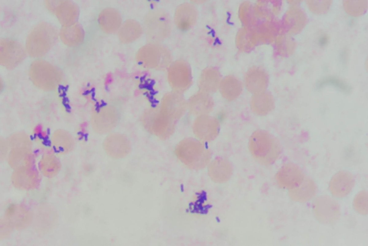 Cocobacili. Cum tratezi și eviți boala