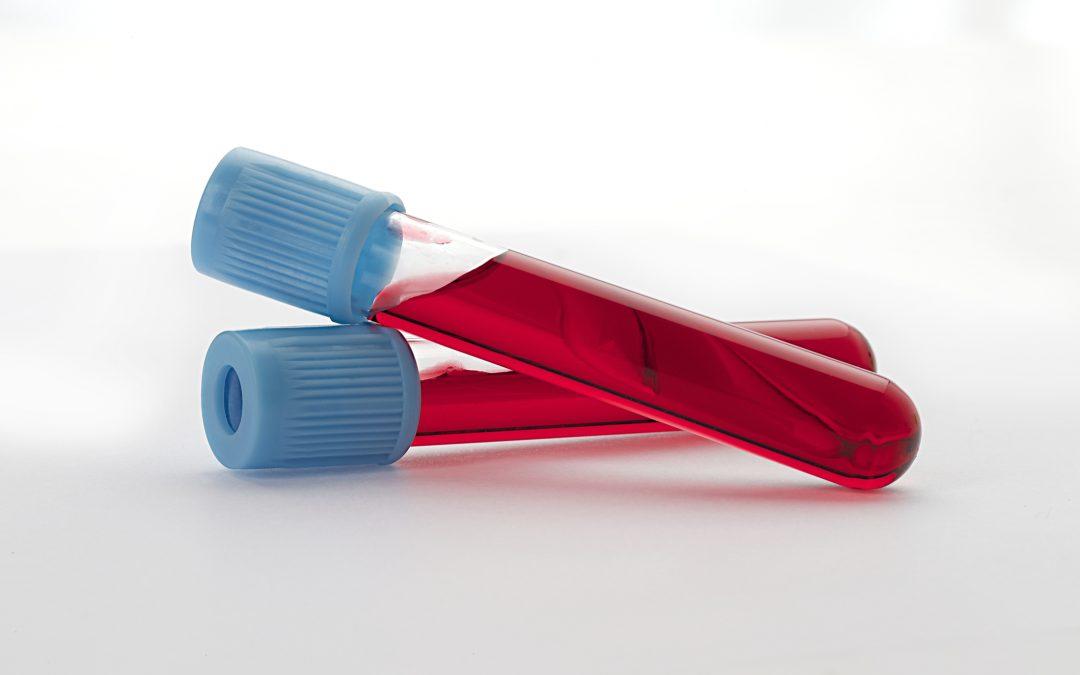 Lista medicamente anticoagulante. În ce cazuri sunt prescrise acestea