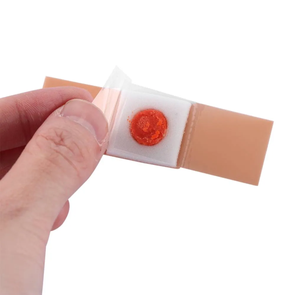 Plasturi pentru negi. Avantajele acestei metode de vindecare spre ...