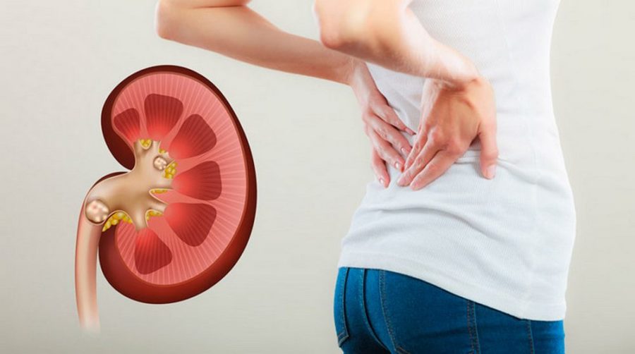 Cât durează eliminarea unei pietre la rinichi. Metode de tratament ...