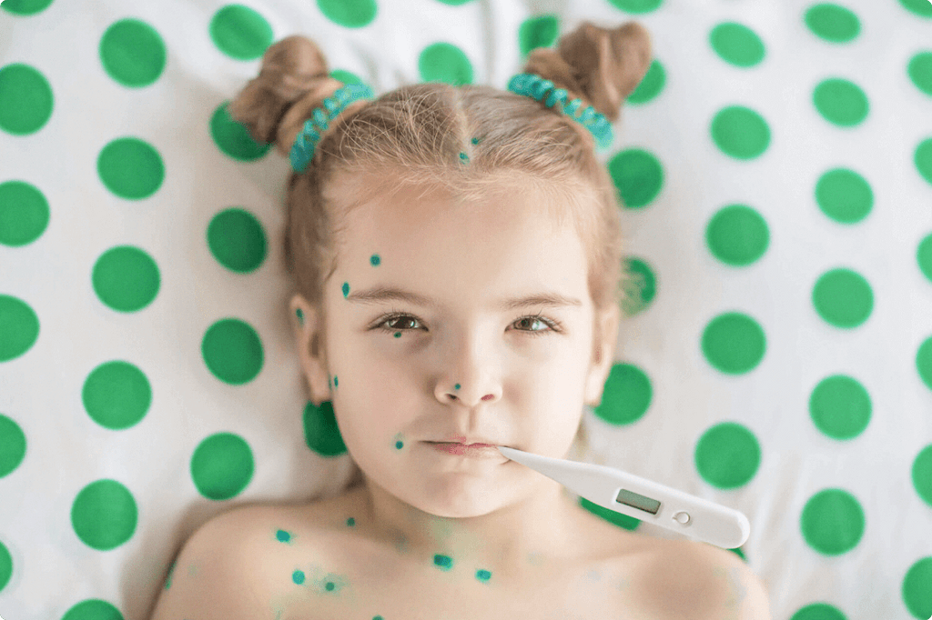 Varicela la copii poze. Cât durează perioada de recuperare