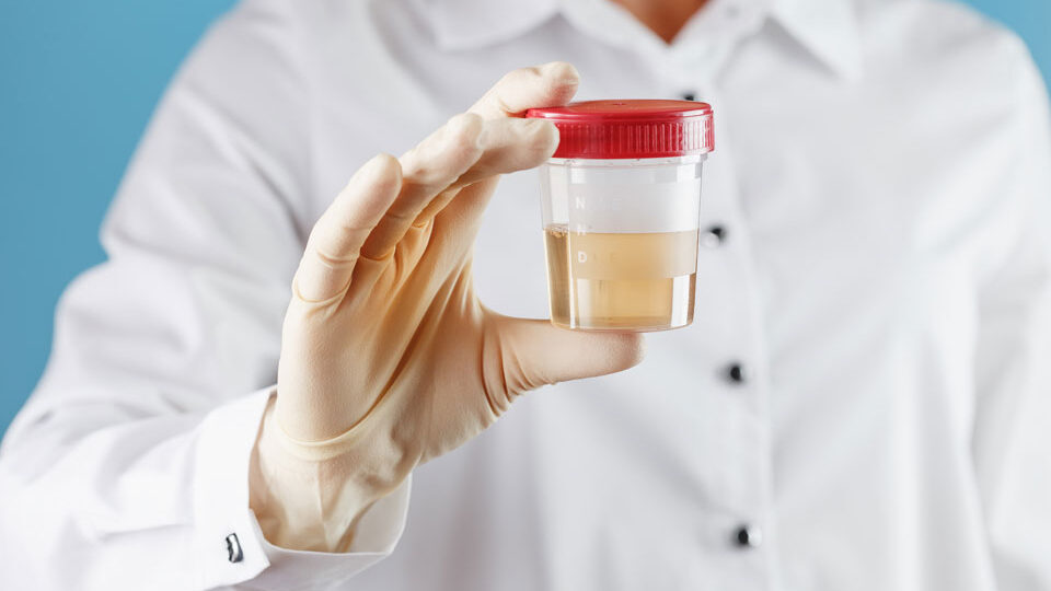 Leucocite în urină 500. Ce afecțiuni semnalează un număr ridicat de ...