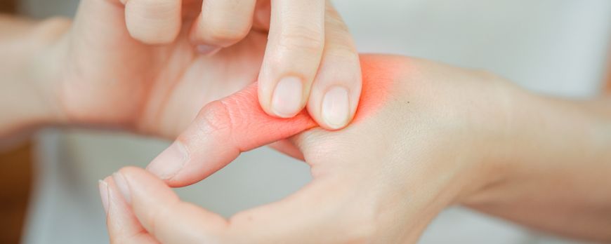 Noduri la degetele de la mâini. Boala poate fi transmisă și pe cale ...