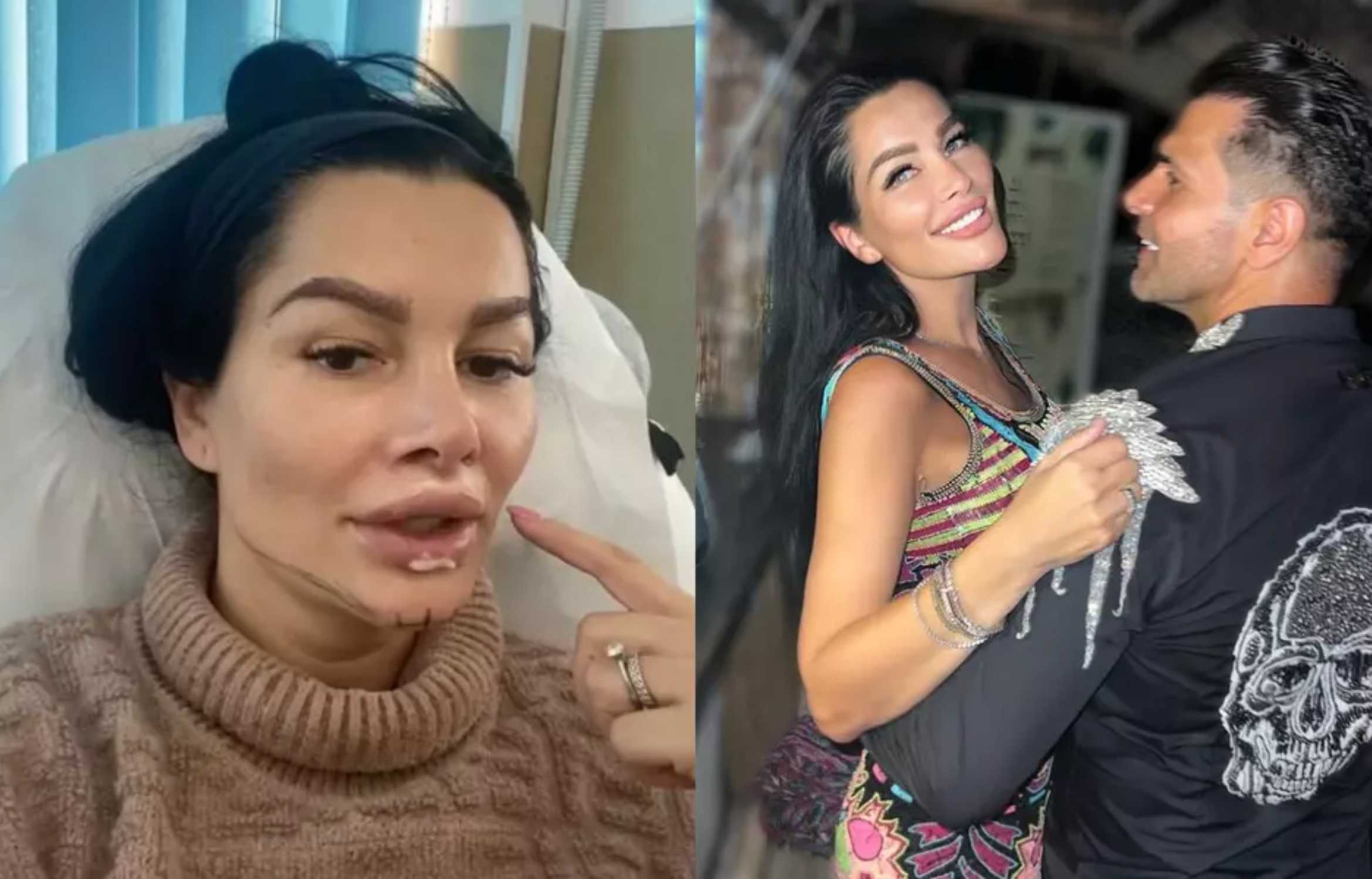 Brigitte Pastramă pare mai tânără după ce și-a scos acidul din buze ...