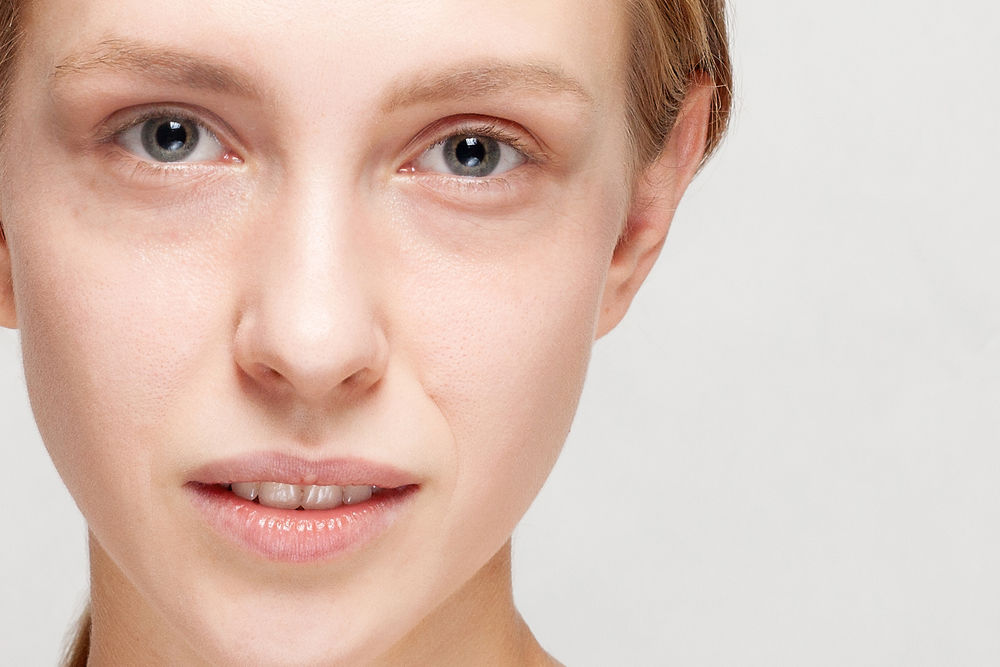 Ochi umflați dimineața. Cum să scapi definitiv de această problemă ...