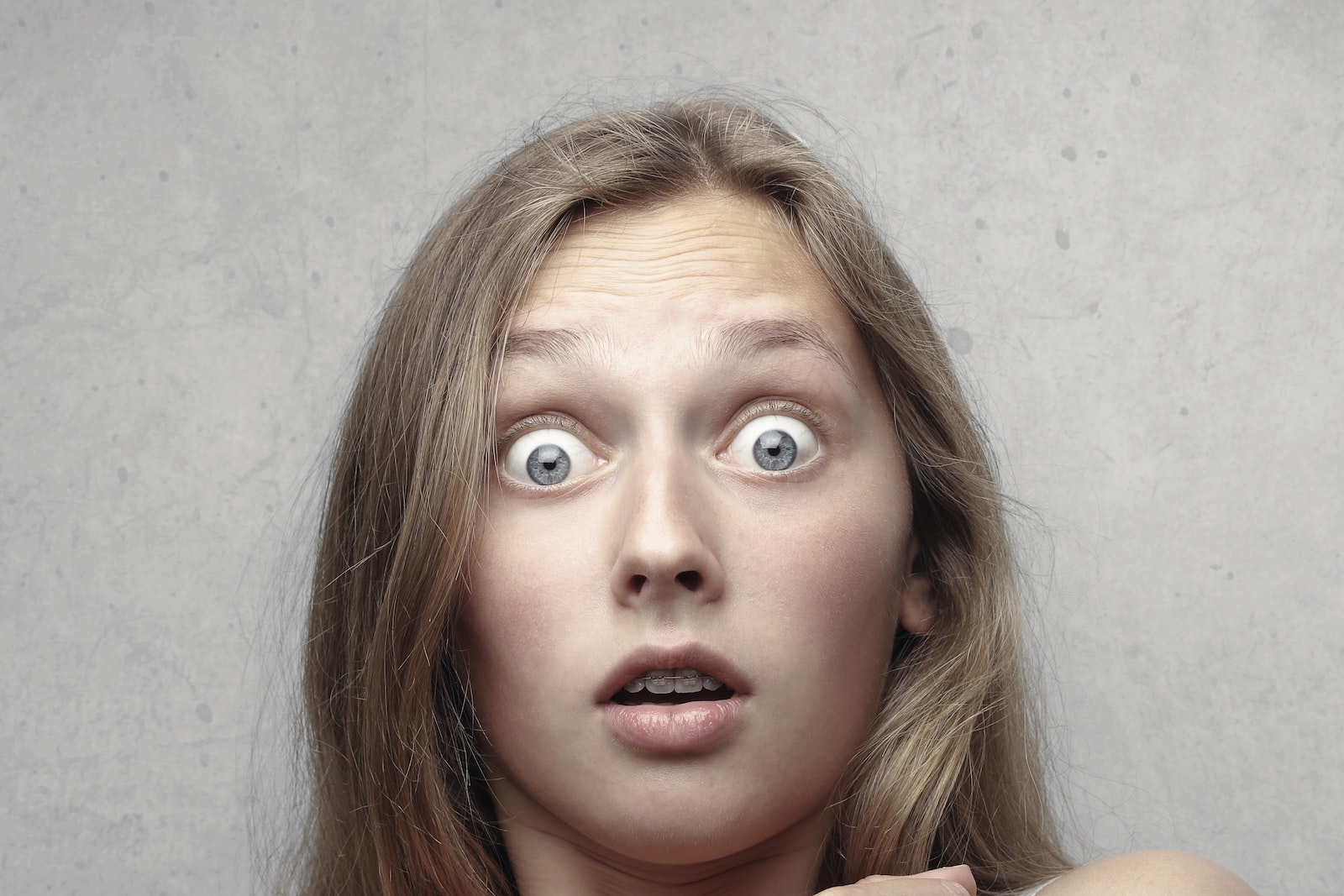 Ce este exoftalmia – evaluare şi diagnostic